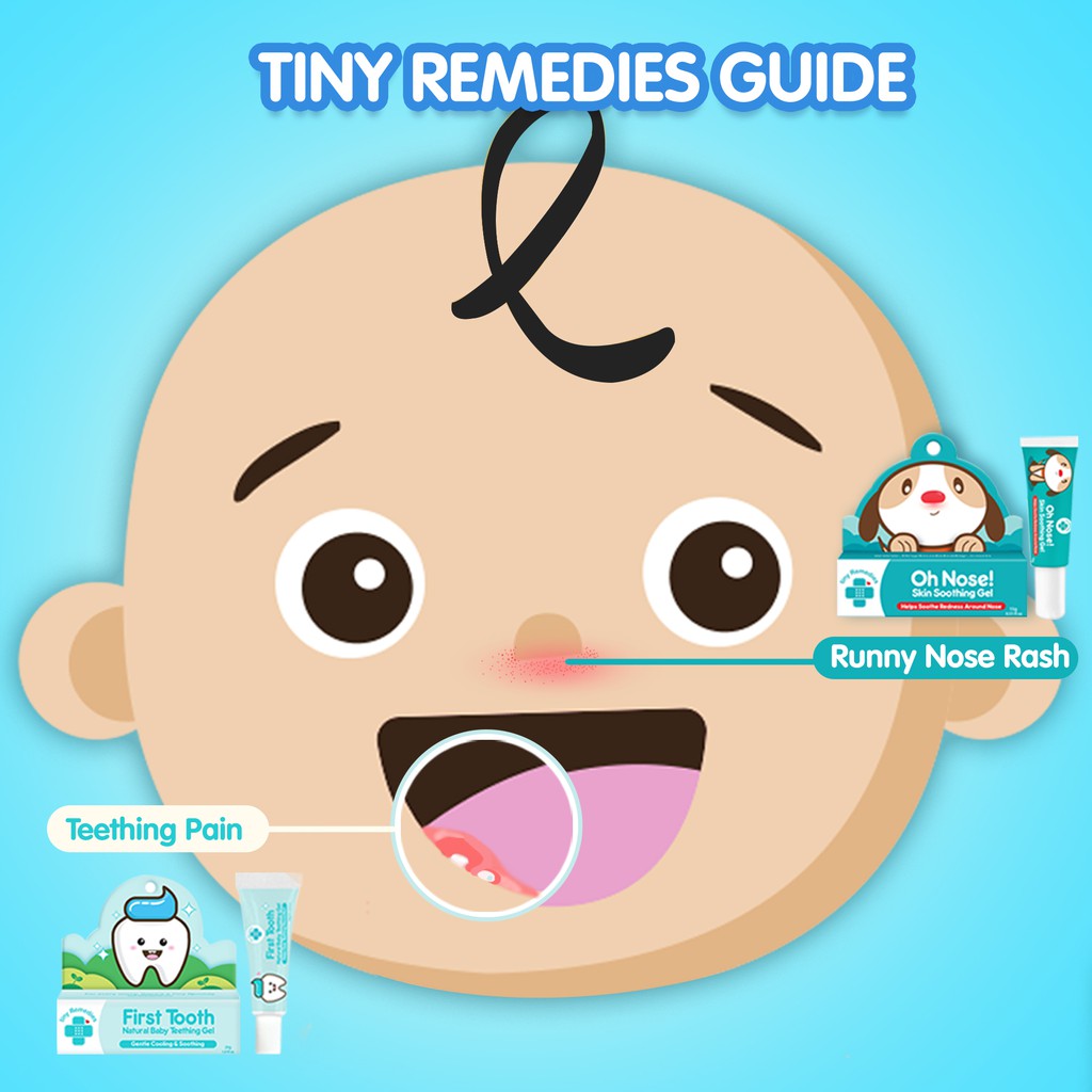 Tiny Remedies First Tooth Natural Baby Teething Gel (20g) – Tiny Buds ...